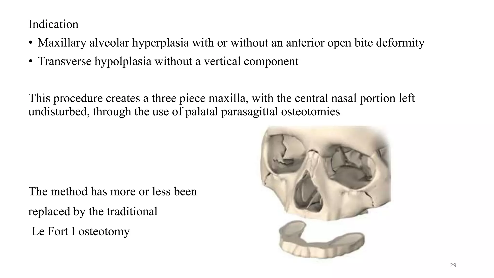 Maxillary osteotomies procedure | PPTX