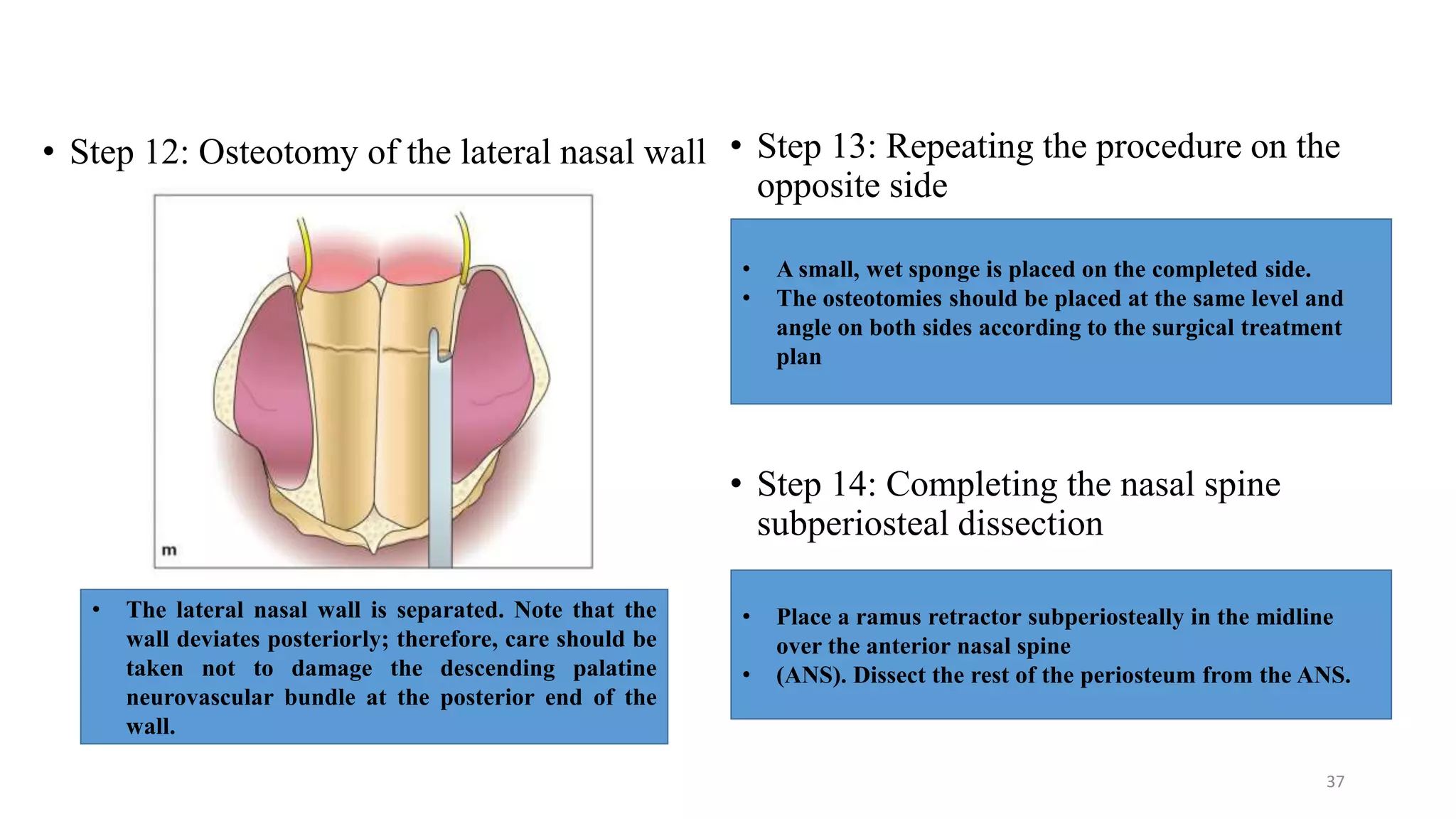Maxillary osteotomies procedure | PPTX