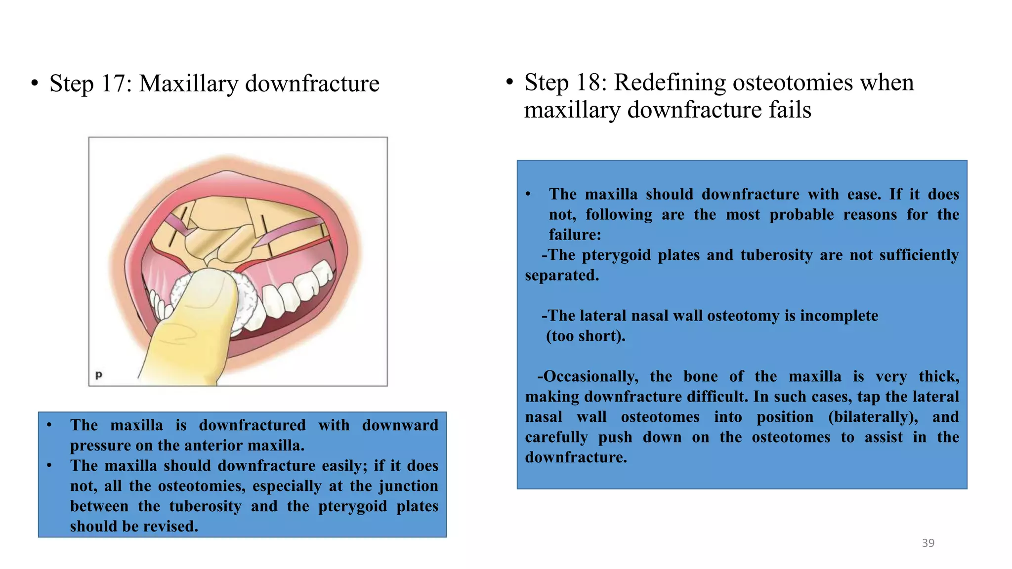 Maxillary osteotomies procedure | PPTX