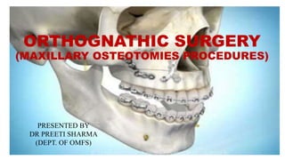 Maxillary osteotomies procedure | PPTX
