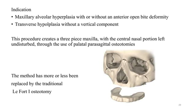 Maxillary osteotomies procedure | PPTX