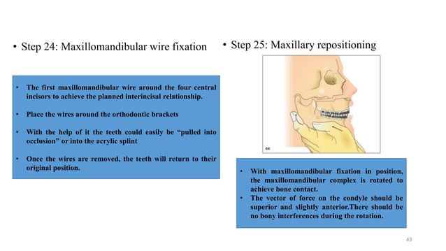 Maxillary osteotomies procedure | PPTX