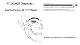 Maxillary osteotomies procedure | PPTX