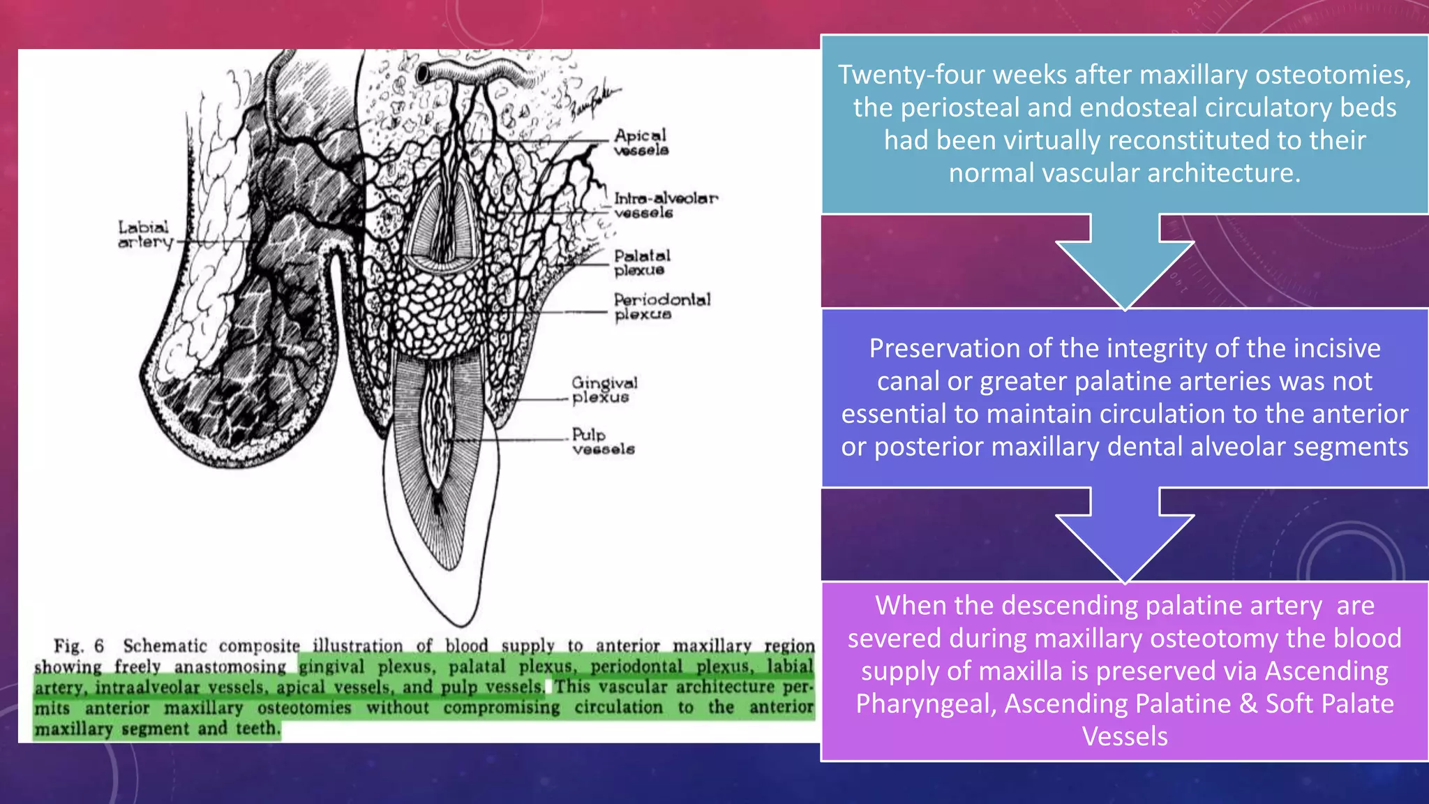 Maxillary osteotomy | PPTX