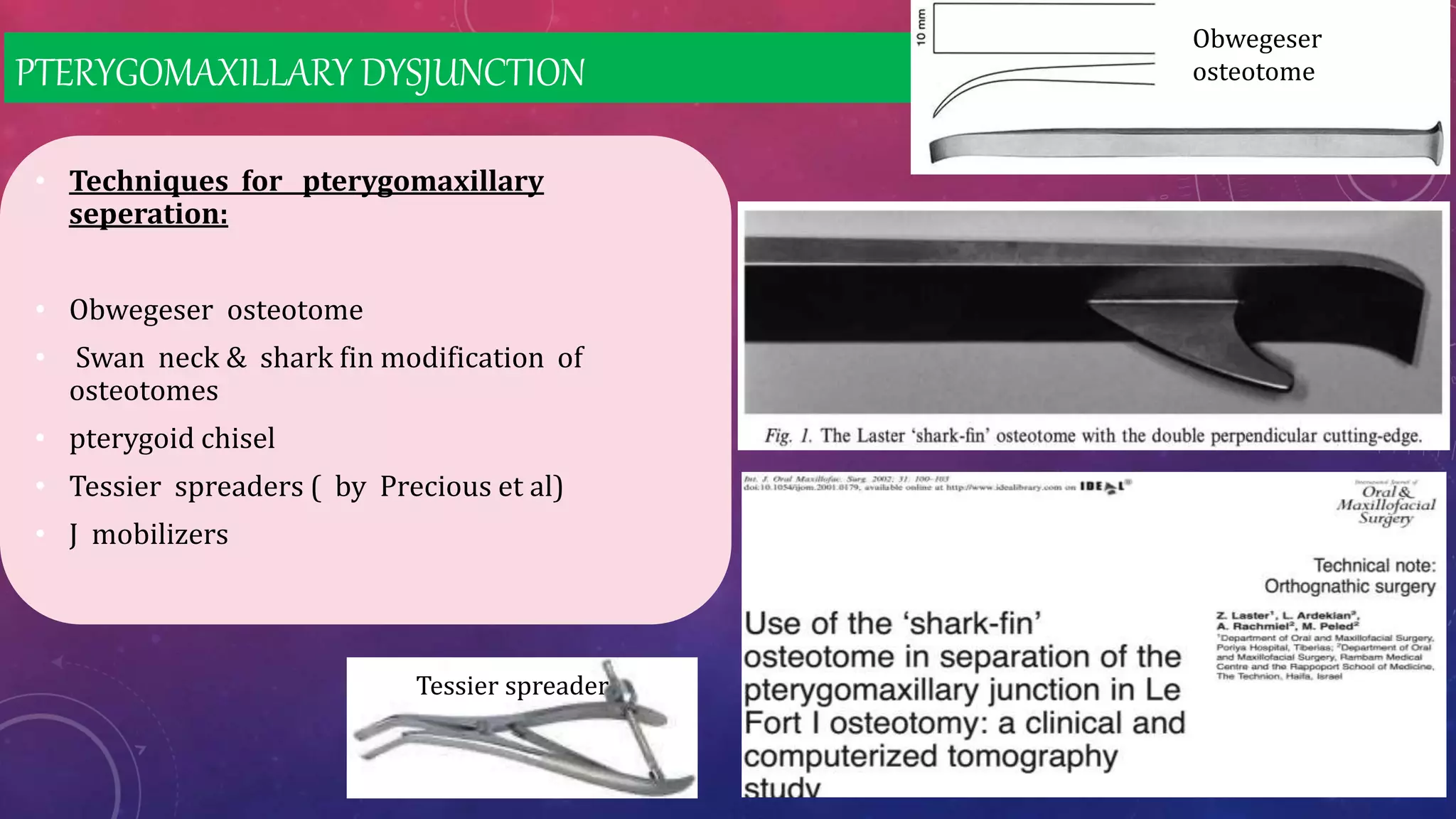 Maxillary osteotomy | PPTX