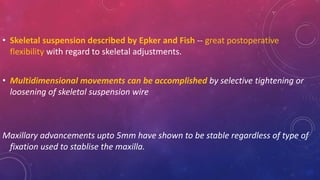 Maxillary osteotomy | PPTX