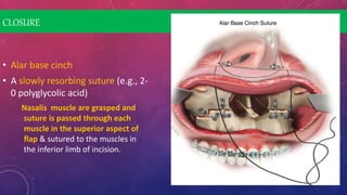 Maxillary osteotomy | PPTX