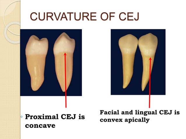 PERMANENT MAXILLARY PREMOLARS | PPTX