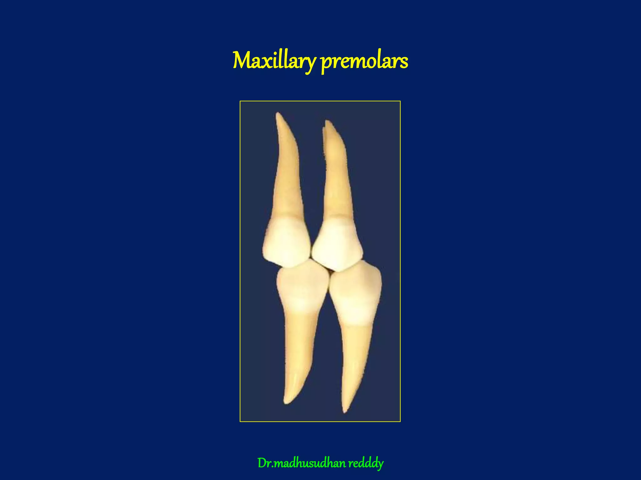 class traits of premolars and Maxillary 1st premolar.pptx
