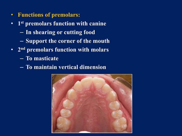 class traits of premolars and Maxillary 1st premolar.pptx