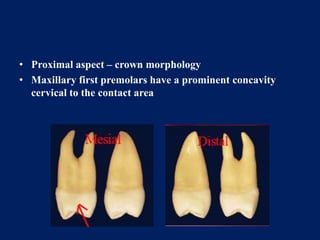 class traits of premolars and Maxillary 1st premolar.pptx