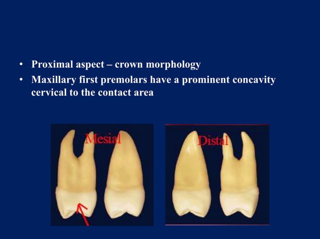 class traits of premolars and Maxillary 1st premolar.pptx