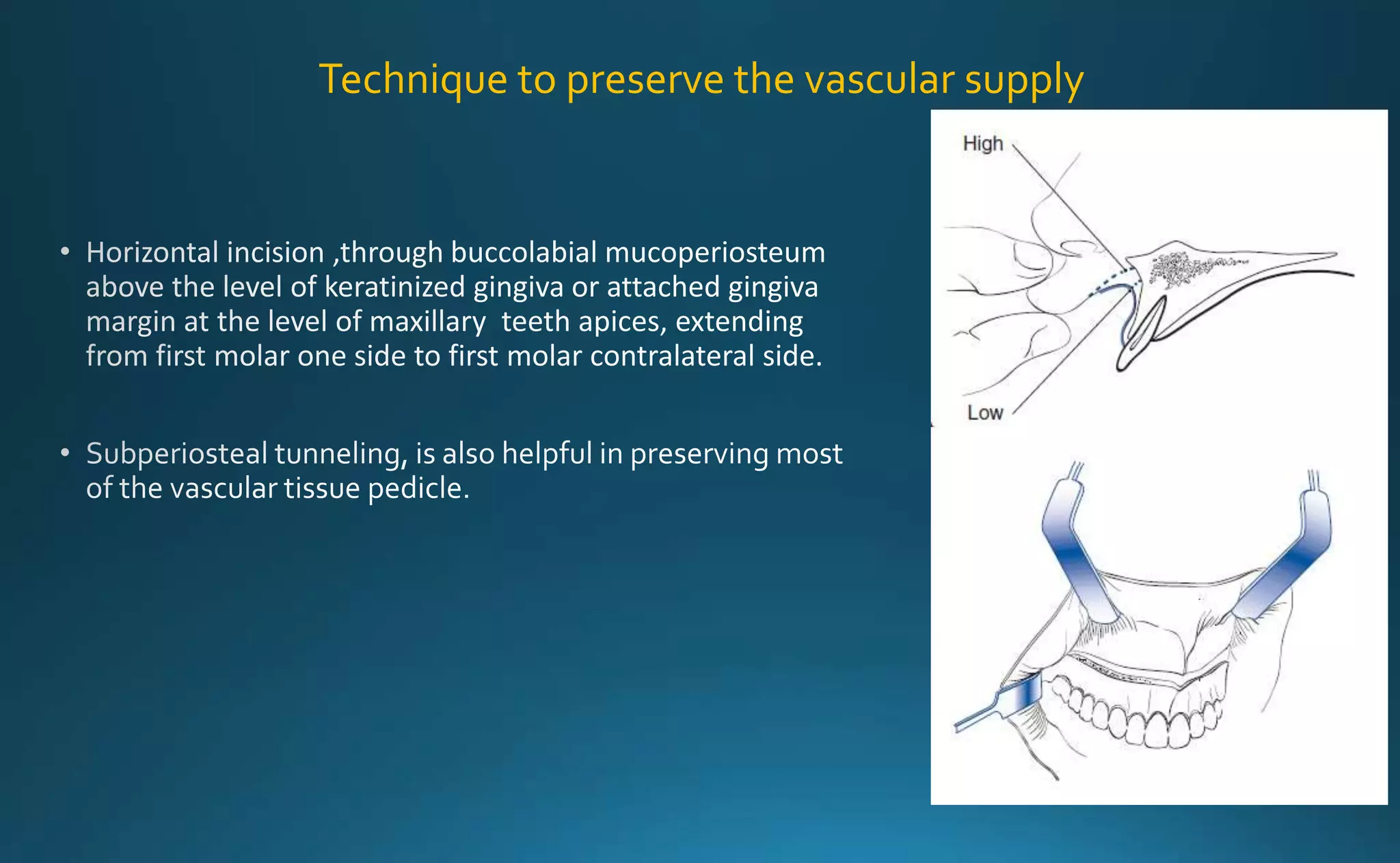 Maxillary procedures and soft tissue changes | PPTX