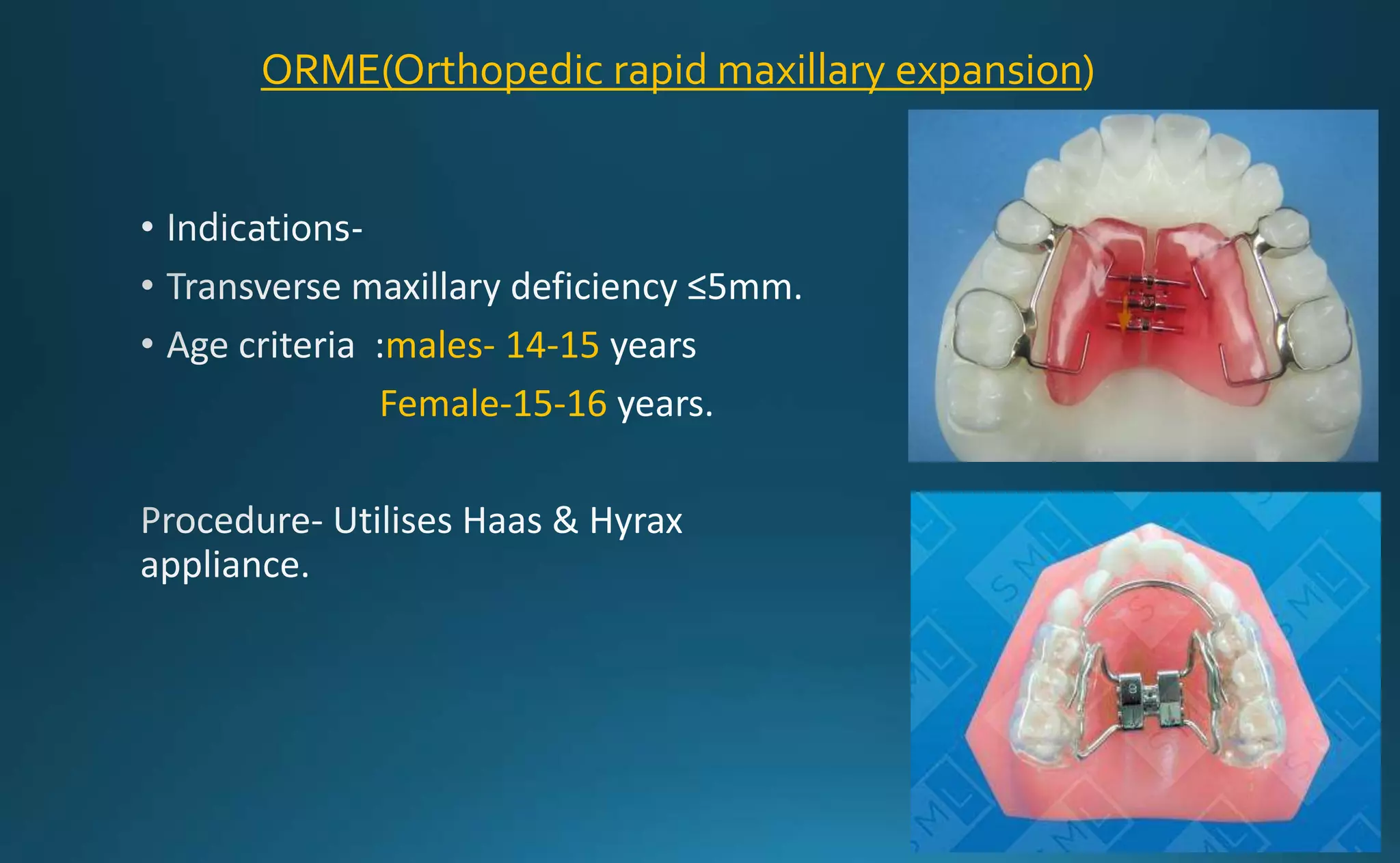 Maxillary procedures and soft tissue changes | PPTX