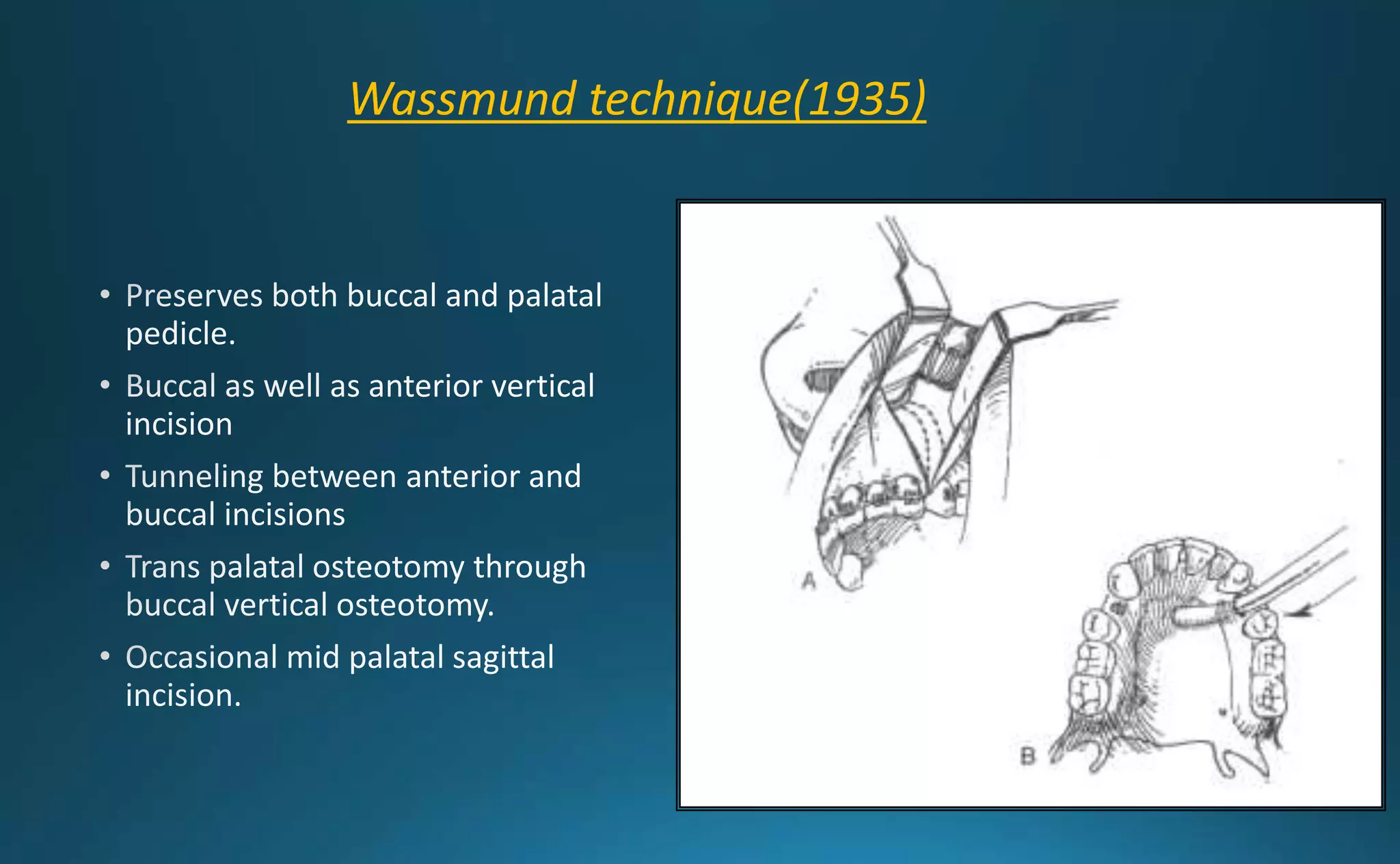 Maxillary procedures and soft tissue changes | PPTX