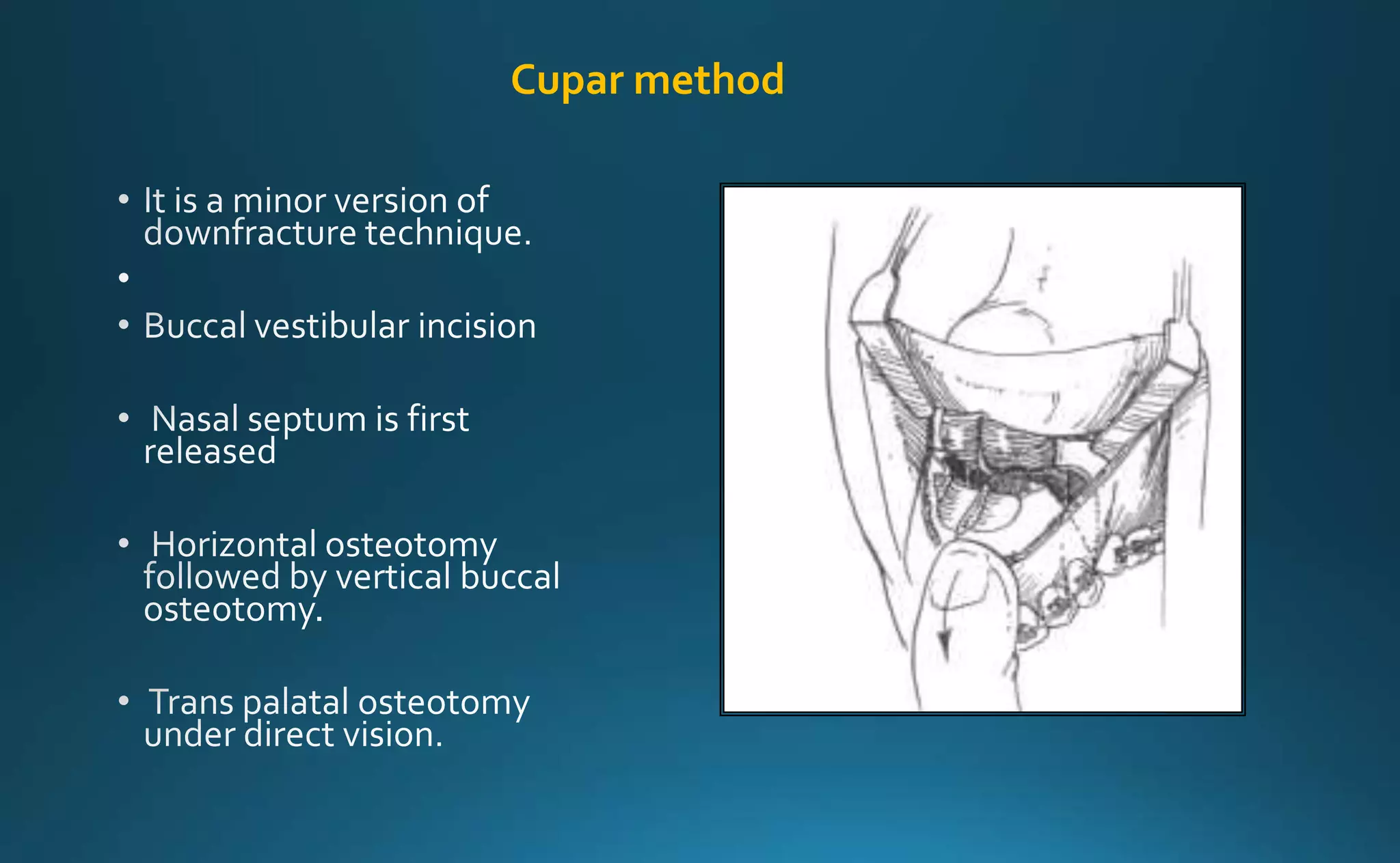 Maxillary procedures and soft tissue changes | PPTX