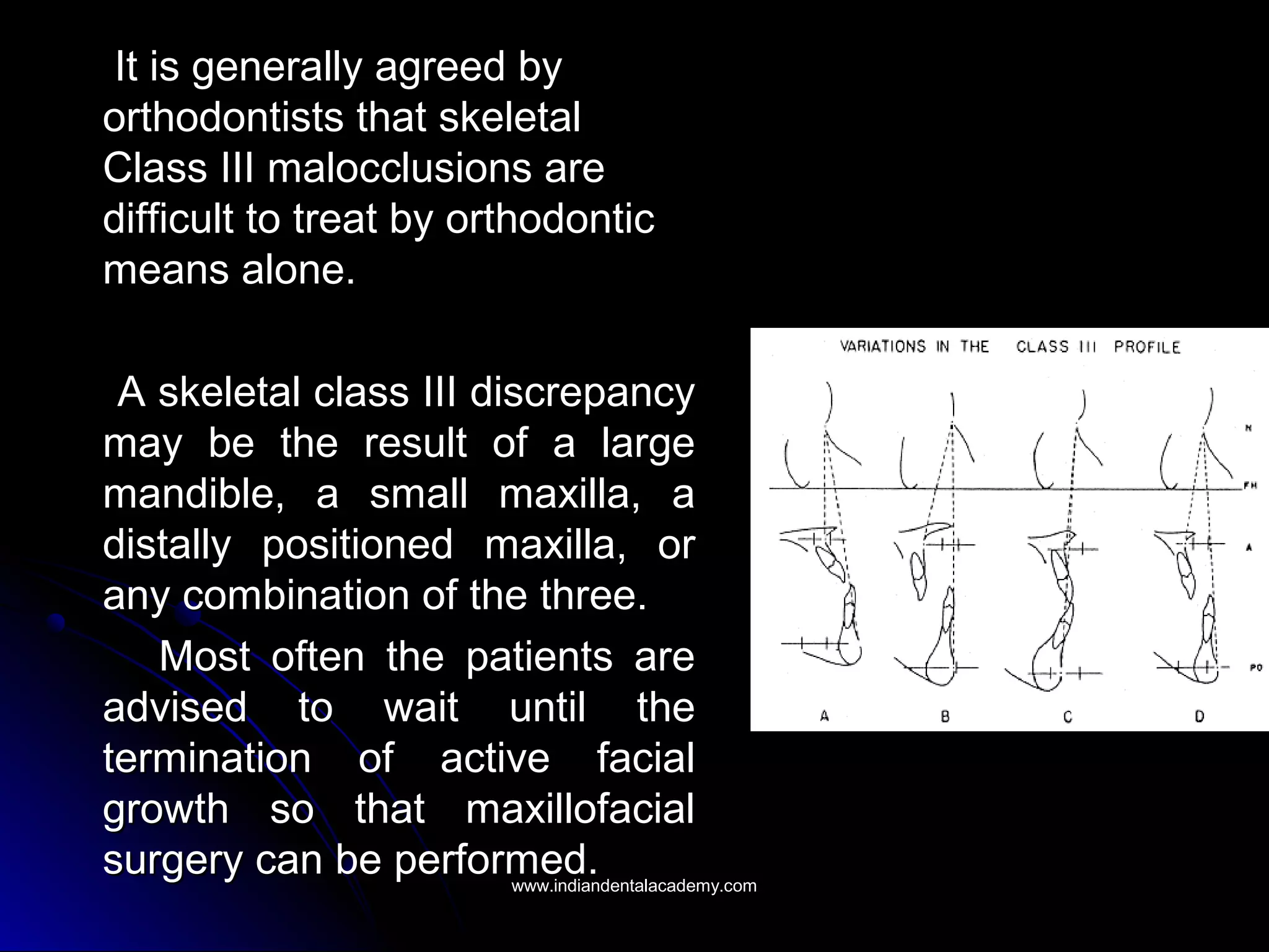 Maxillary protraction in orthodontics | PPT | Dental Health | Diseases ...