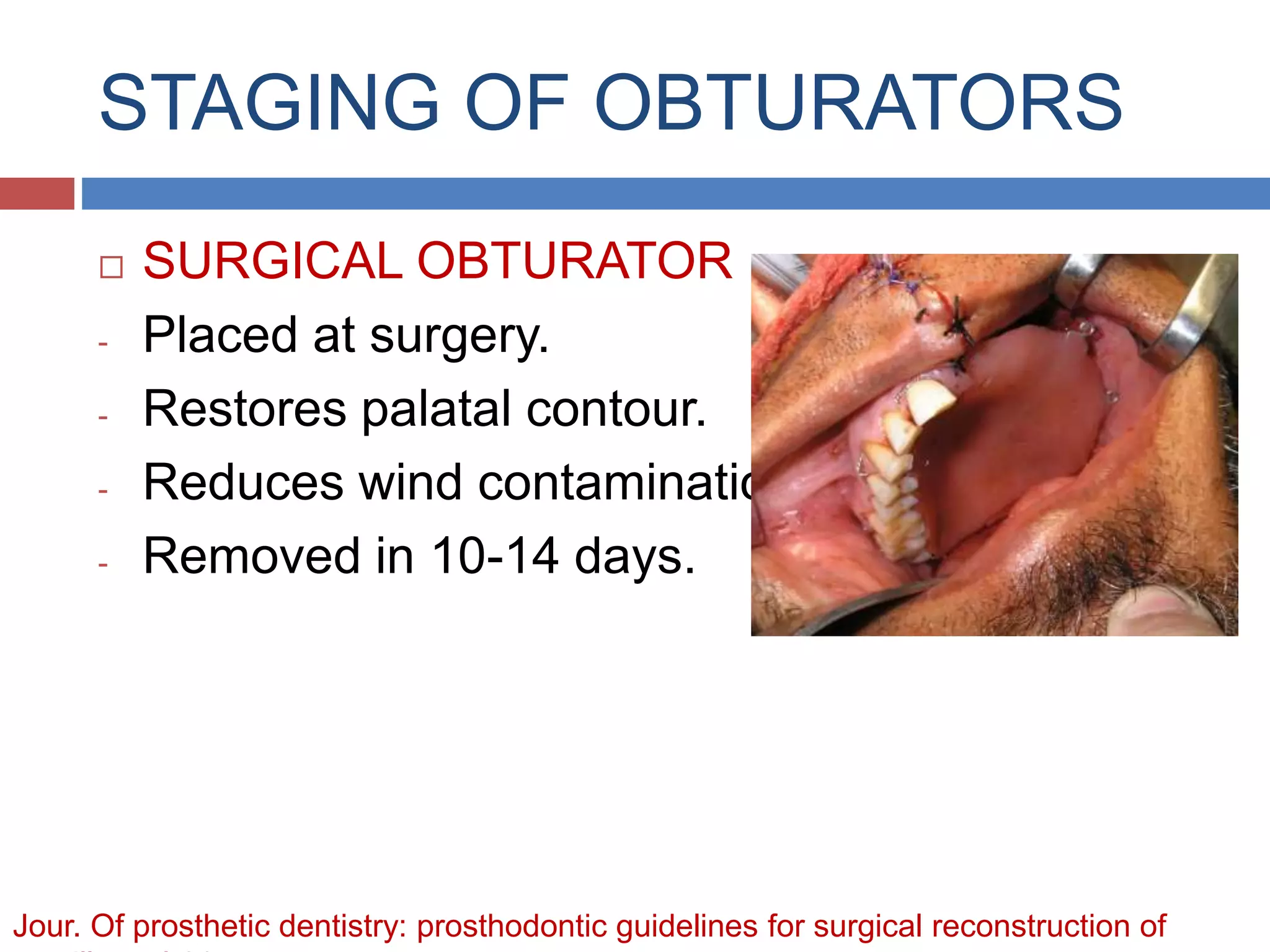 Maxillary reconstruction ih | PPTX