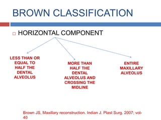 Maxillary reconstruction ih | PPTX