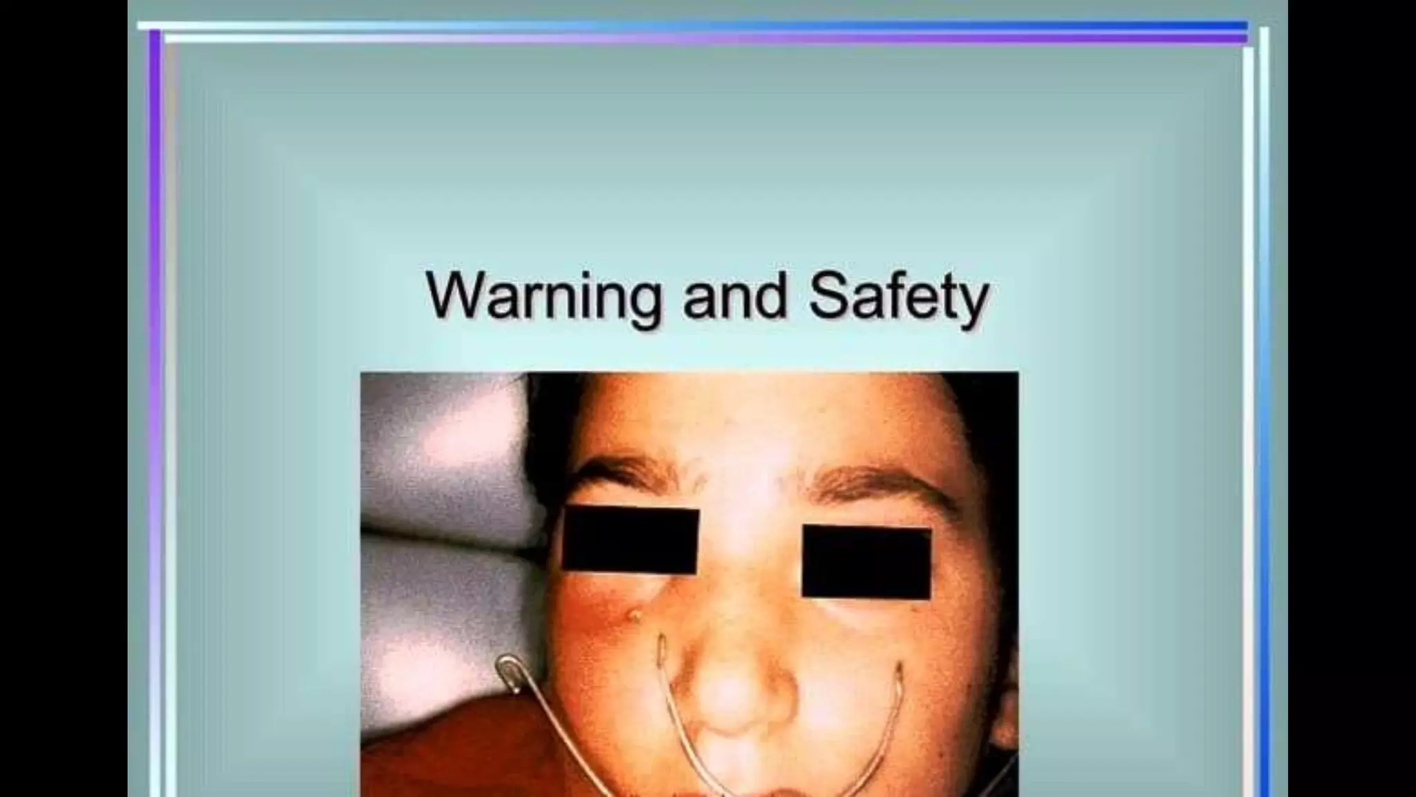 MAXILLARY ROTATION.pptx