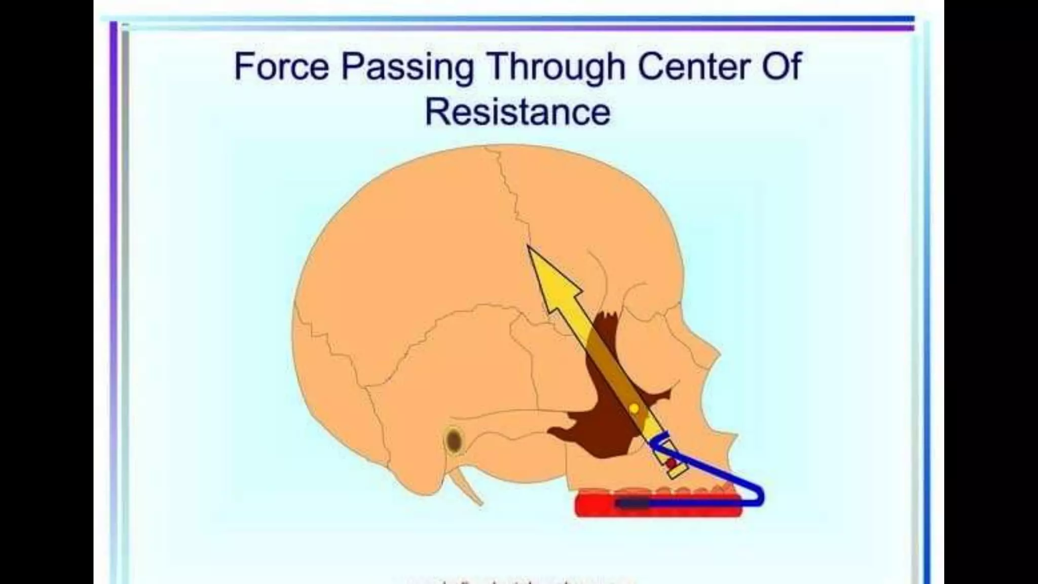 MAXILLARY ROTATION.pptx