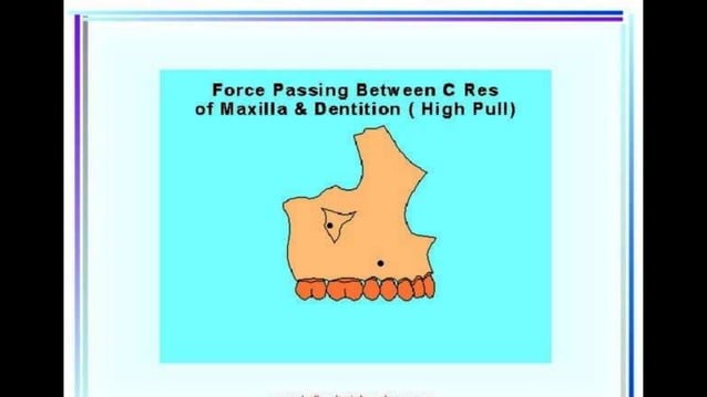 MAXILLARY ROTATION.pptx