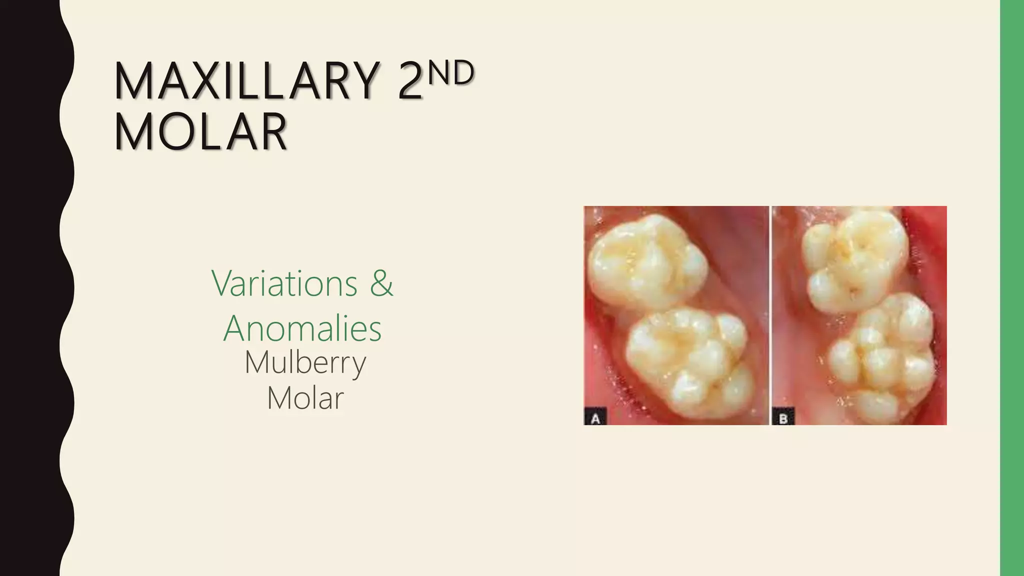 Maxillary second molar | PPTX