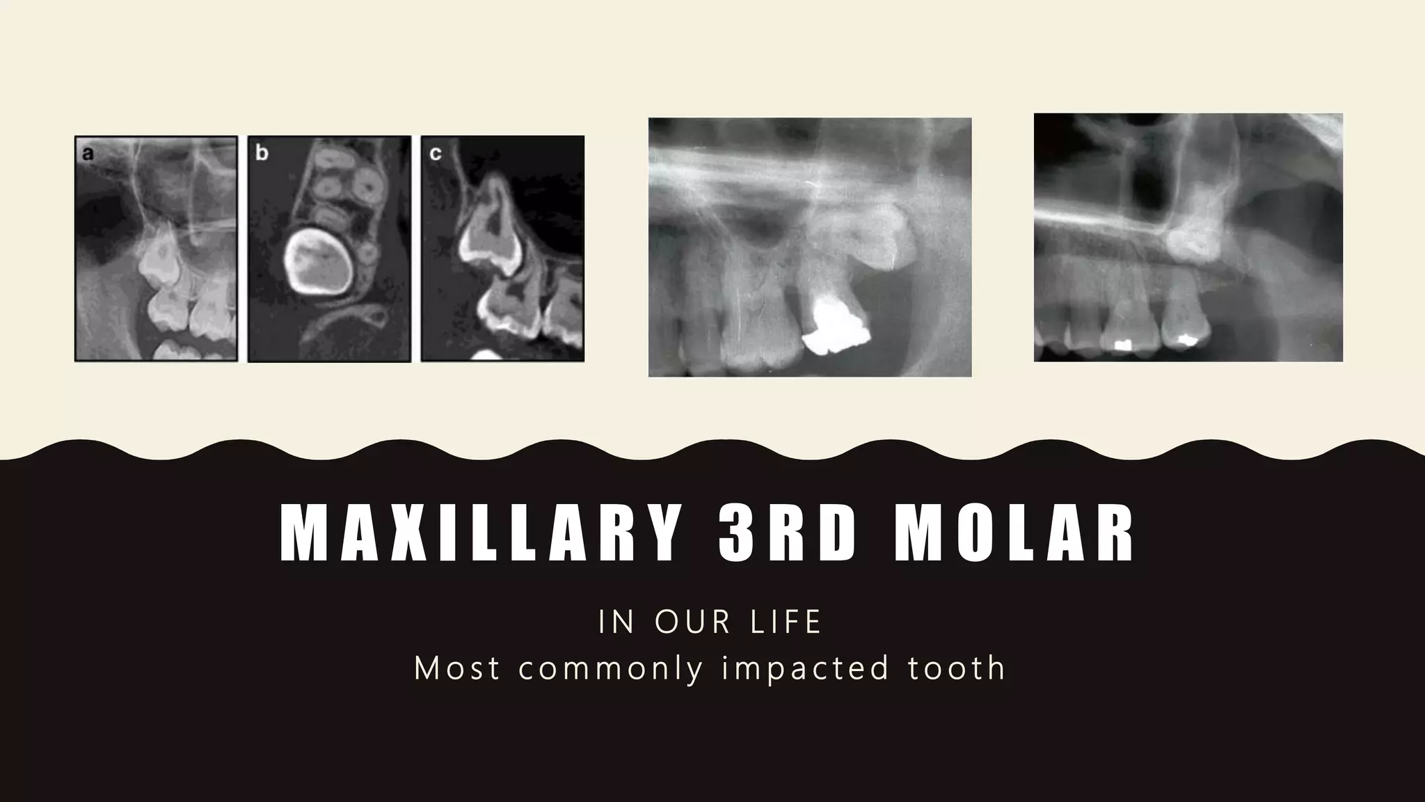 Maxillary second molar | PPTX