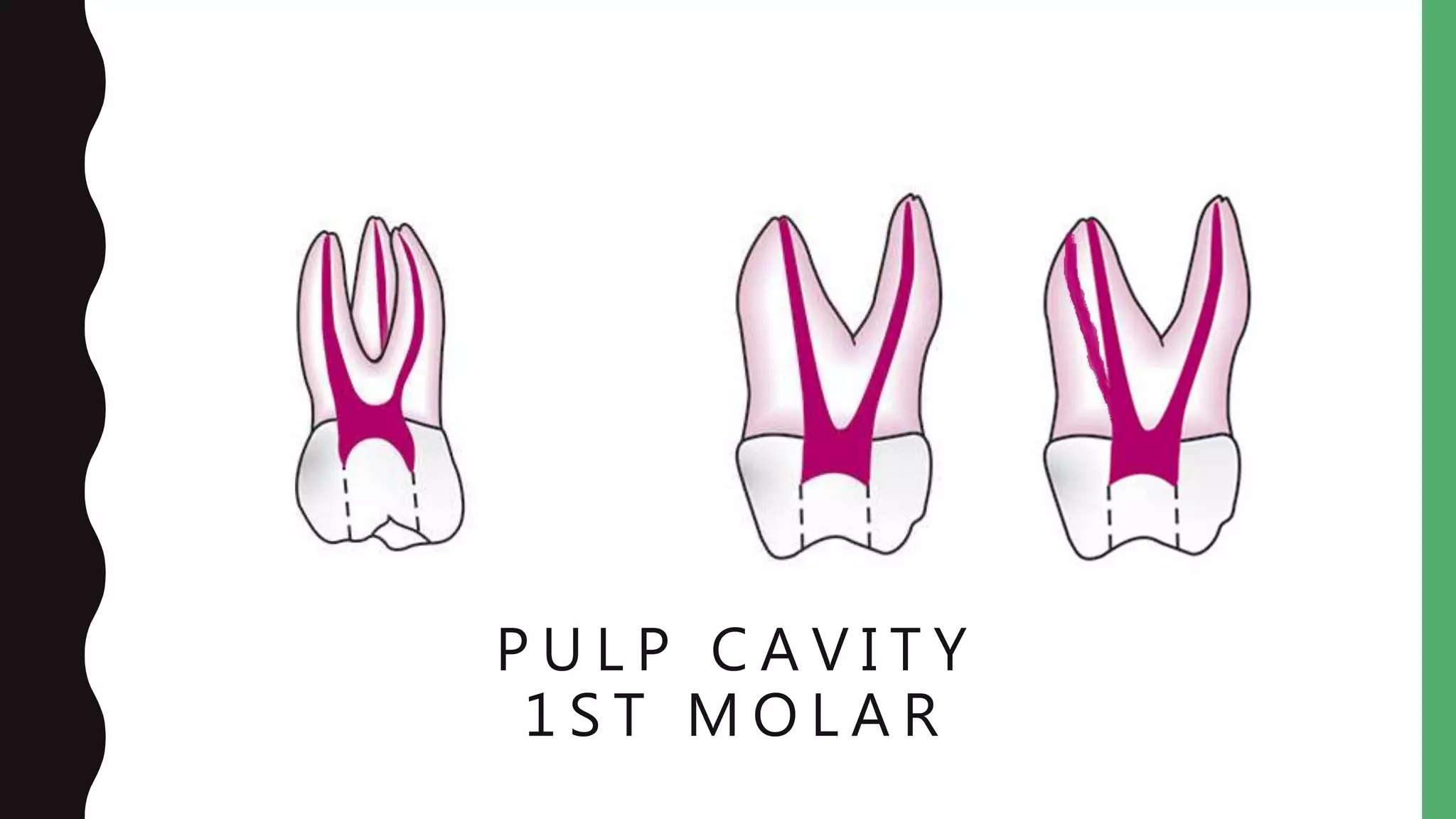 Maxillary second molar | PPTX
