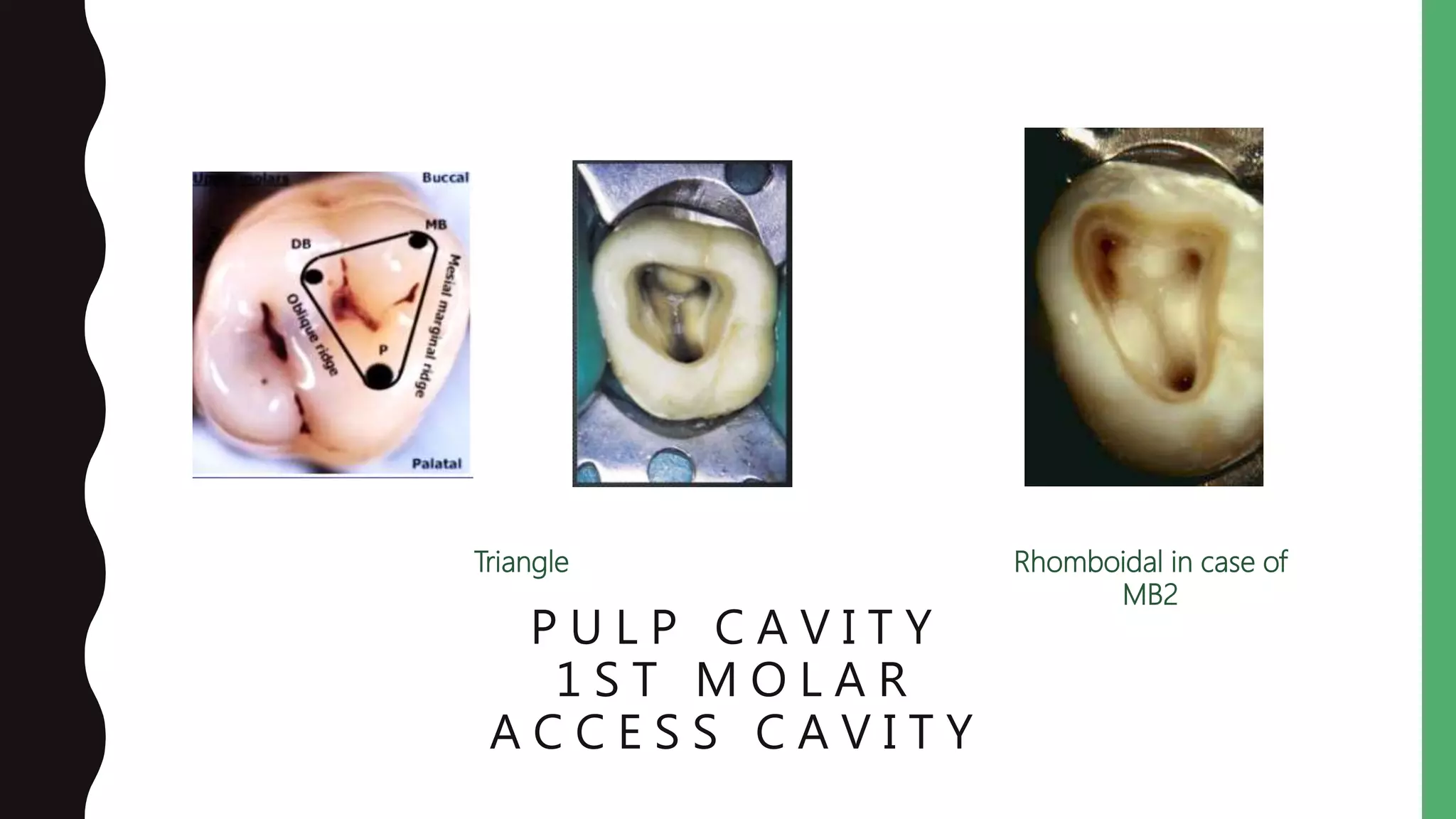 Maxillary second molar | PPTX