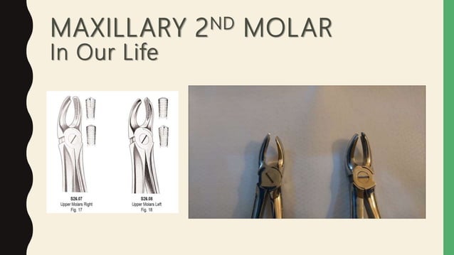 Maxillary second molar | PPTX | Dental Health | Diseases and Conditions