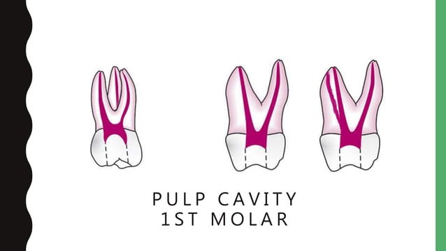 Maxillary second molar | PPTX | Dental Health | Diseases and Conditions