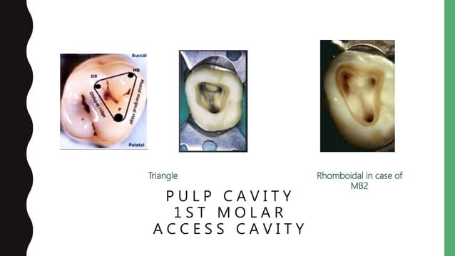 Maxillary second molar | PPTX | Dental Health | Diseases and Conditions