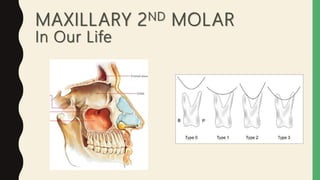 Maxillary second molar | PPTX