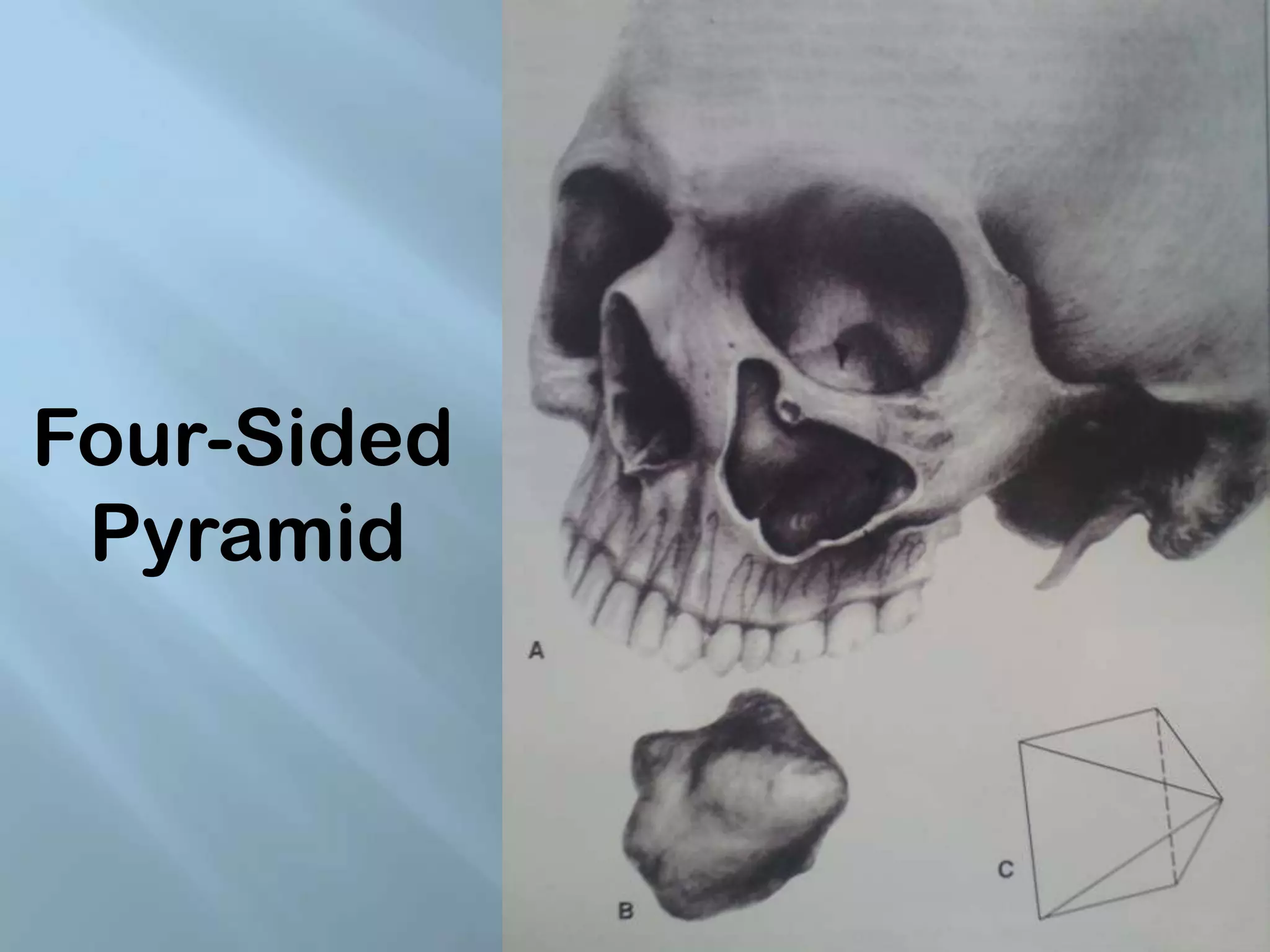 Maxillary Sinus | PPTX