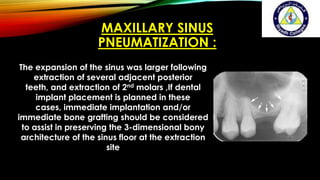Maxillary sinus | PPTX