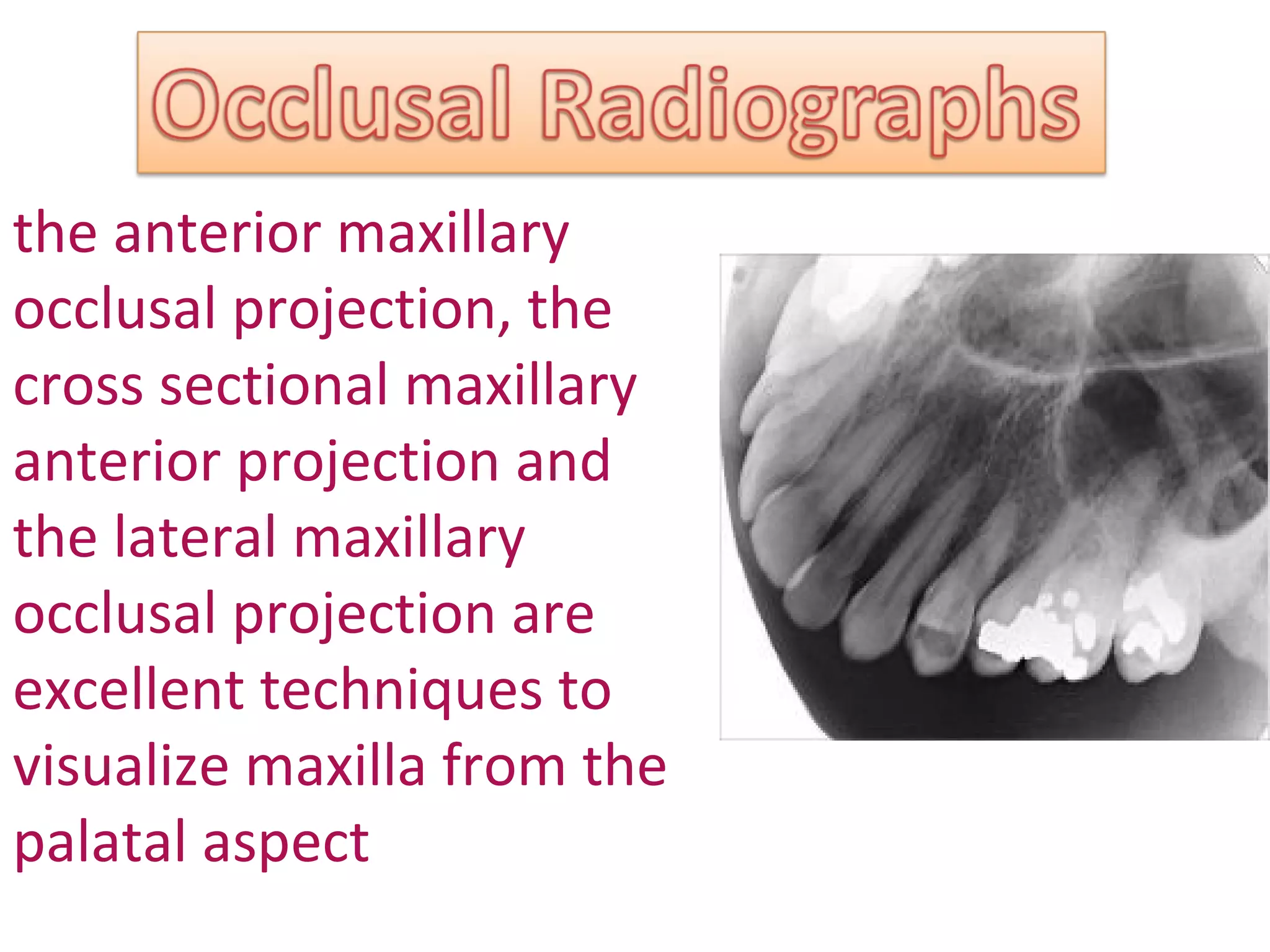 radiology of Maxillary sinus | PPT
