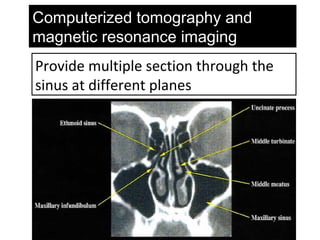 radiology of Maxillary sinus | PPT