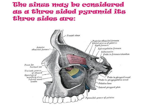 radiology of Maxillary sinus | PPT