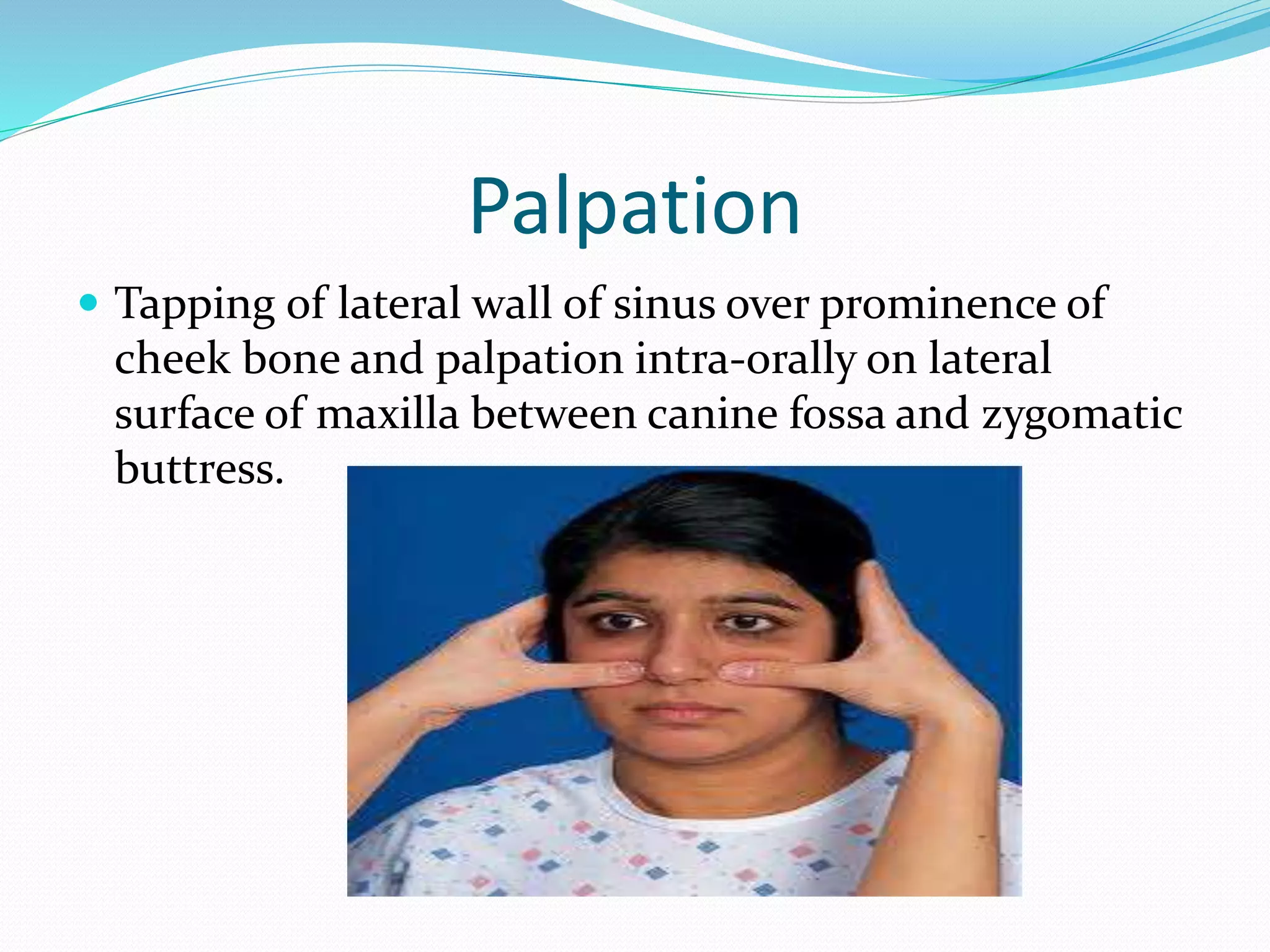 Maxillary sinus.pptx gaurav | PPTX