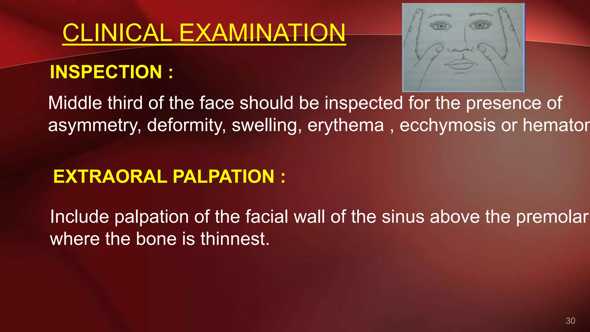 Maxillary sinus | PPTX