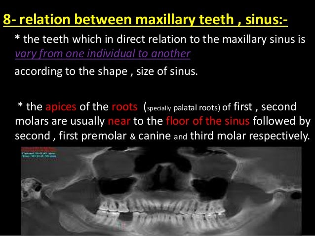 Maxillary sinus