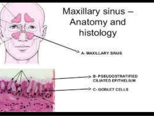 What Is A Maxillary Sinus _ Maxillary Sinus – KGLWKW