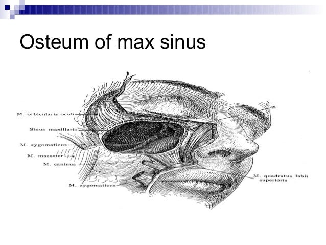 Maxillary sinus for 2nd year BDS