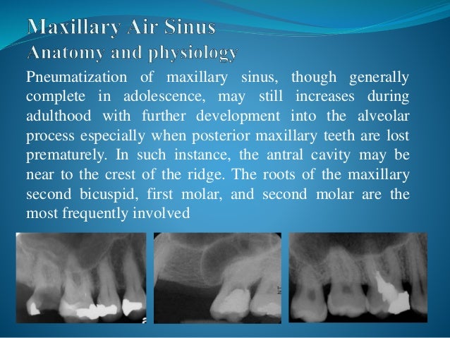 Maxillary Sinus