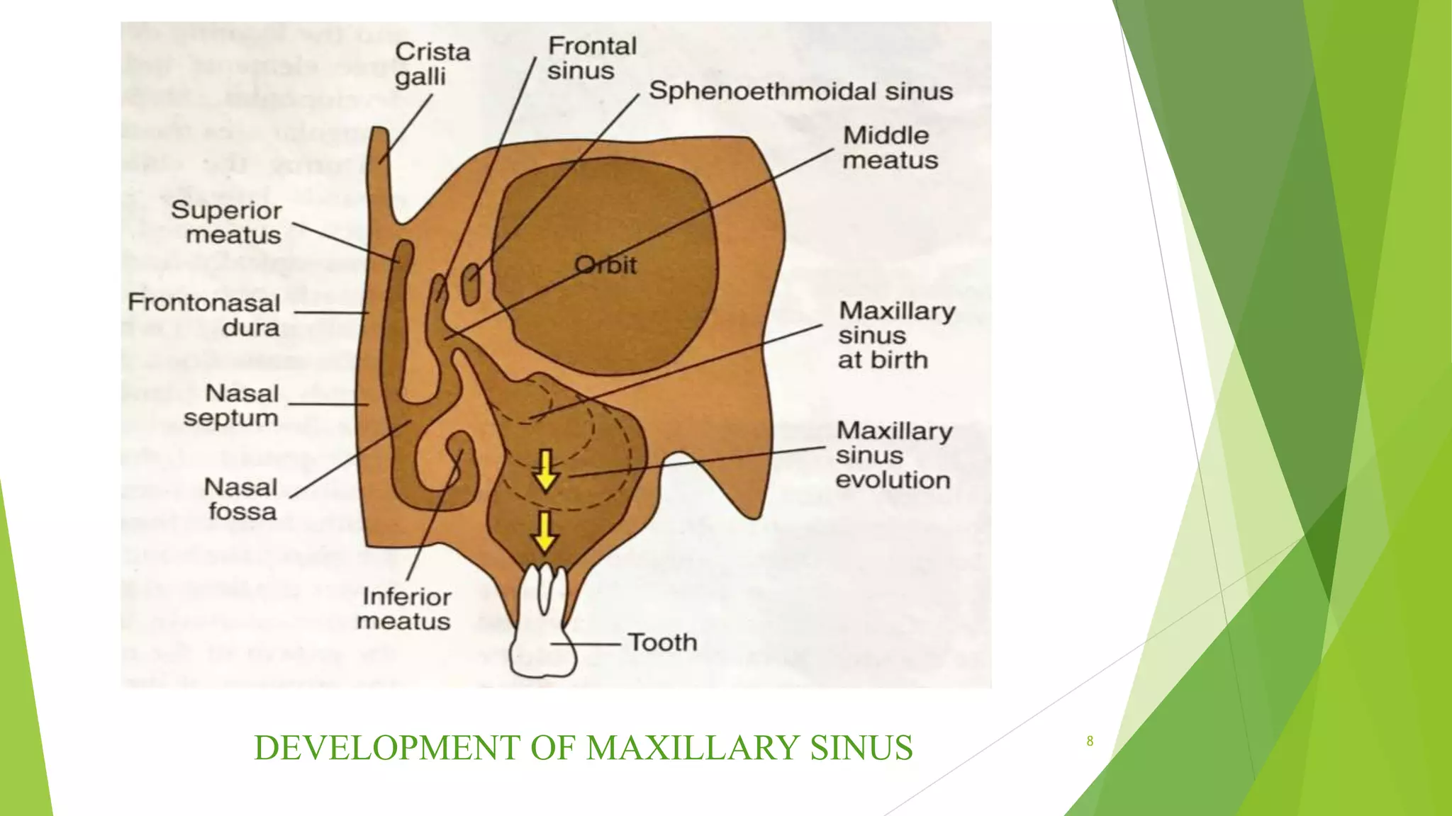 Maxillary Sinus | PPTX