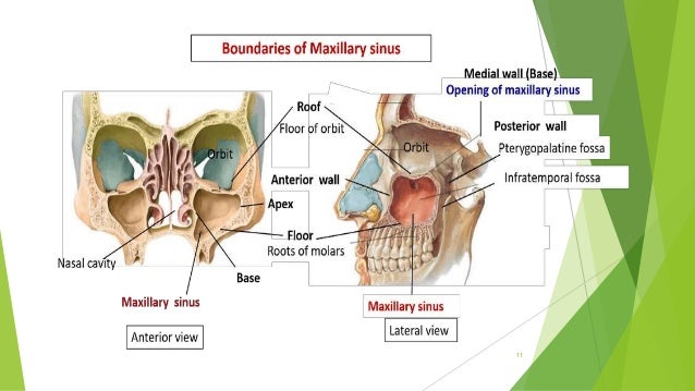 Maxillary Sinus