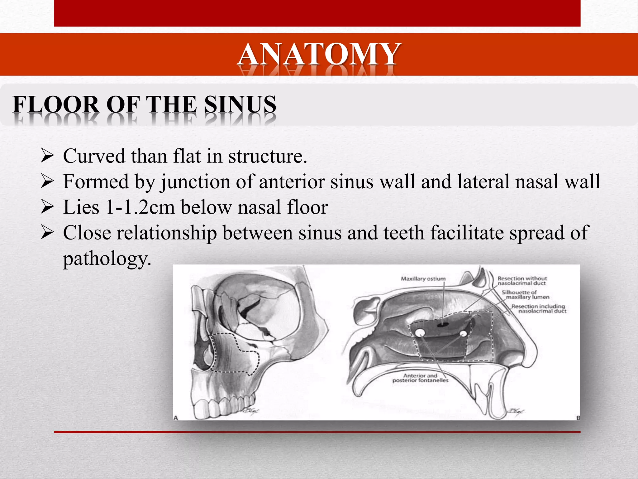 Maxillary sinus.pptx