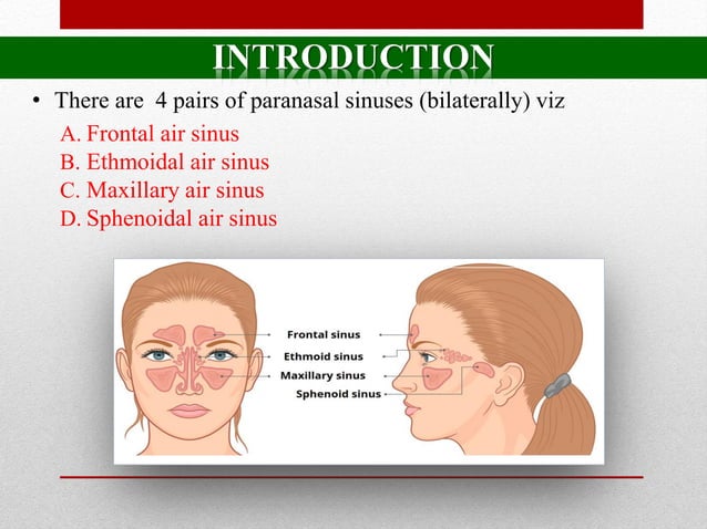 Maxillary sinus.pptx | Ear, Nose and Throat Conditions | Diseases and ...