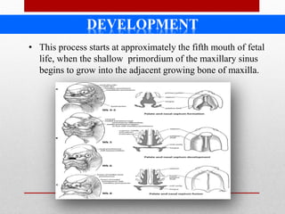 Maxillary sinus.pptx | Ear, Nose and Throat Conditions | Diseases and ...